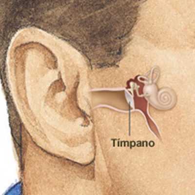 CIRURGIA DE TIMPANOPLASTIA EM BLUMENAU - Clínica de Otorrino em Blumenau